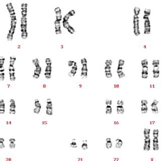 A Karyotype Of A Normal Female 46 Xx Reproduced Courtesy Of Human