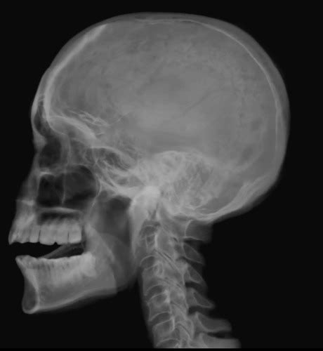 Anatomical Imaging 6 Flashcards Quizlet