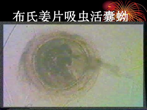 吸虫纲概述word文档在线阅读与下载无忧文档