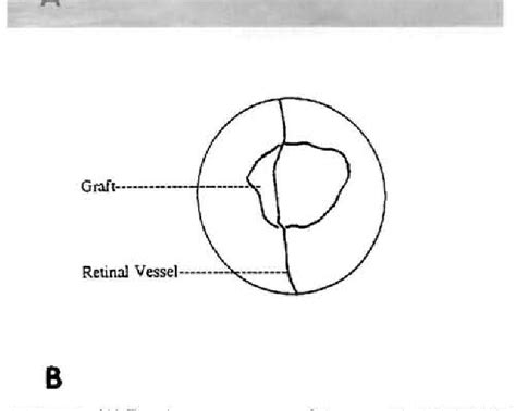 Figure 1 From Subretinal Space And Vitreous Cavity As Immunologically