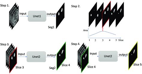diagram of the framework of two neural networks including unet1 and