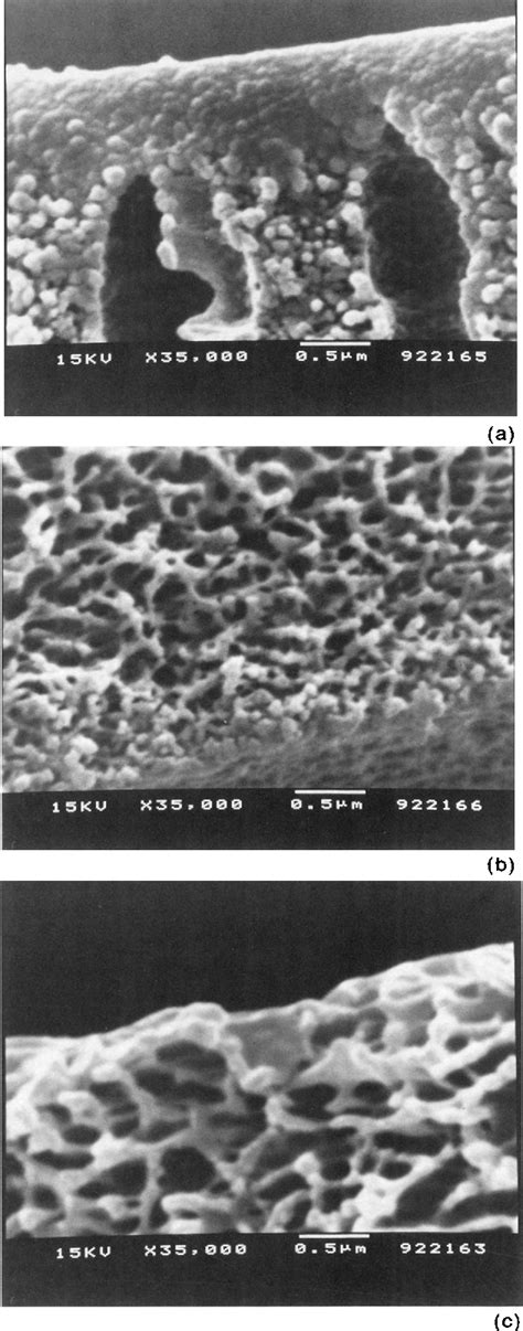 Figure 1 From The Formation Of Nodular Structures In The Top Layer Of Ultrafiltration Membranes