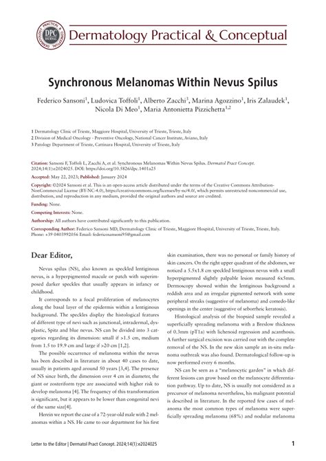 Pdf Synchronous Melanomas Within Nevus Spilus