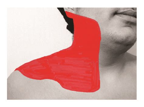 A Anatomy Of The Cervical Plexus The Cervical Plexus Is Seen Download Scientific Diagram