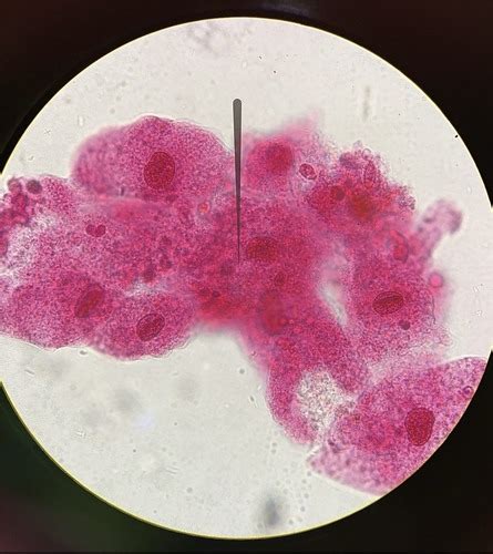 Biol Lab Protist Identification Quiz Flashcards Quizlet