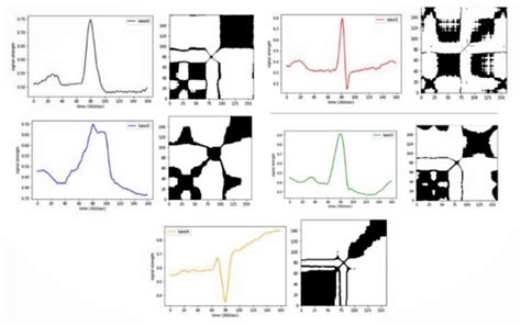Interpreting Arrhythmia Classification Using Deep Neural Network And