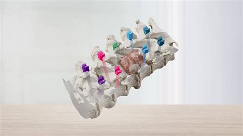 Mixed Reality Viewer 3d Spine Surgical Planning Brainlab