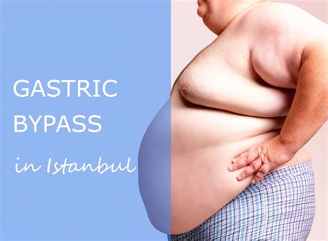 Gastric Bypass In Turkey Obesity Clinic Istanbul