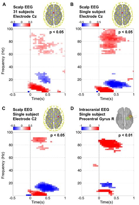 Comparison Of Intracranial Eeg With Scalp Eeg In Group And Single Download Scientific Diagram