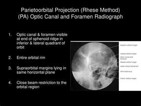 Ppt Radiography Of The Orbits Powerpoint Presentation Free Download