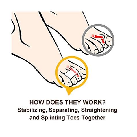 Welnove 6Pcs Hammer Toe Straightener Hammer Toe Splints Toe Cushioned Sportsfit Uk