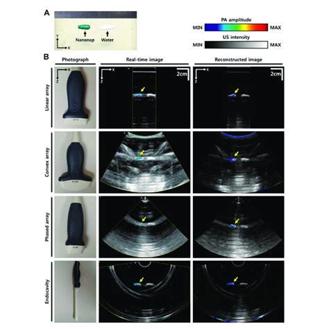Patus Images Using Different Transducers A Photograph Of The