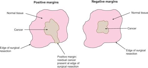 Wires Systems Biology And Medicine Vol 10 No 3