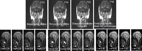 Figure 1 From 4d Alignment Of Bidirectional Dynamic Mri Sequences Semantic Scholar