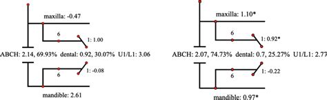 Overjet Analysis Left And Corrected Analysis Right Of V Group