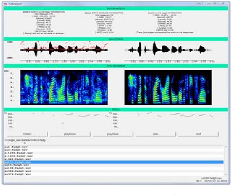 Figure 1 From A New Speech Quality Measure For Speech Database Verification System Semantic