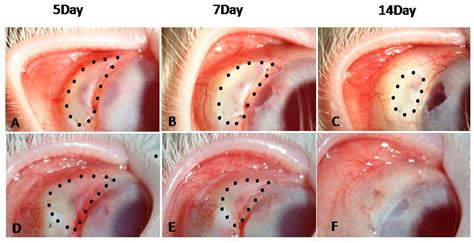 The Effect Of Dry Eye Disease On Scar Formation In Rabbit Glaucoma
