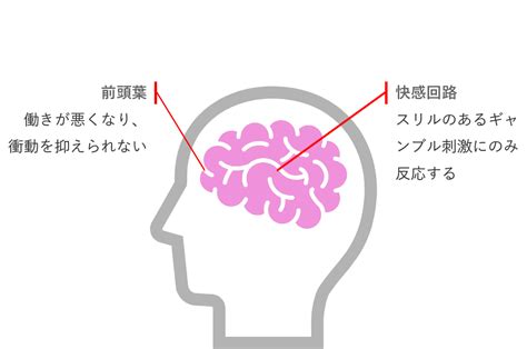 ギャンブル依存症患者の脳内