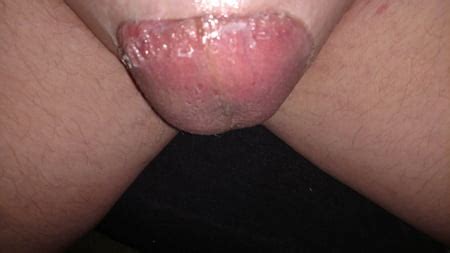 Super Glue Fun 24 Pics XHamster