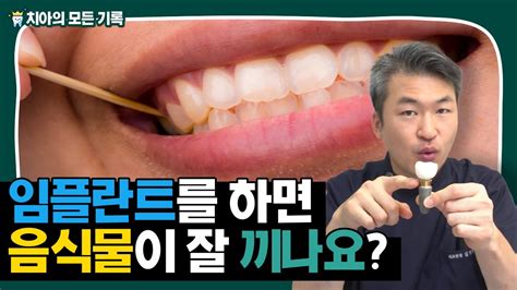 임플란트 한 후 음식물이 많이 껴요 임플란트 음식물 끼임 ㅣ수원 김기록치과 Youtube