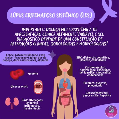Lúpus Eritematoso Sistêmico Patholovers