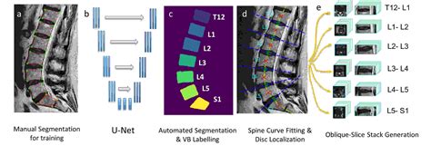 Deepspine Automated Lumbar Vertebral Segmentation Disc Level