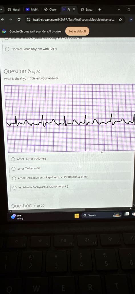 Normal Sinus Rhythm With Pacs Question 6 Of 20 What Is The Rhythm Select Your Answer Atrial