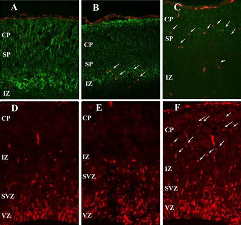 Cell Cycle Markers Are Expressed In The Cdk5 E16 5 Neocortex A C Download Scientific