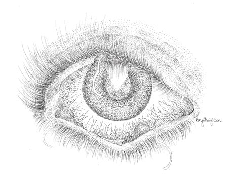 Bipolar Sketch At Explore Collection Of Bipolar Sketch