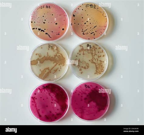 Types Of Agar Plates At Sofia Taylor Blog