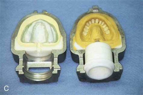 Prosthetic Polymers And Resins Pocket Dentistry