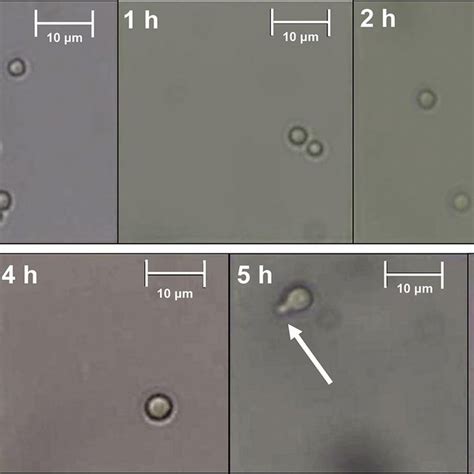 Germination Of Aspergillus Nidulans Wild Type Wt Strain Download