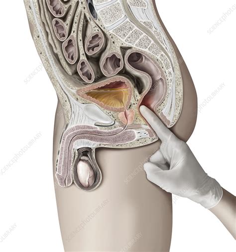Rectal Exam Illustration Stock Image C Science Photo Library