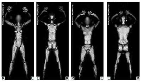 Court TSA Violated Federal Law With Body Scanner Deployment Aero