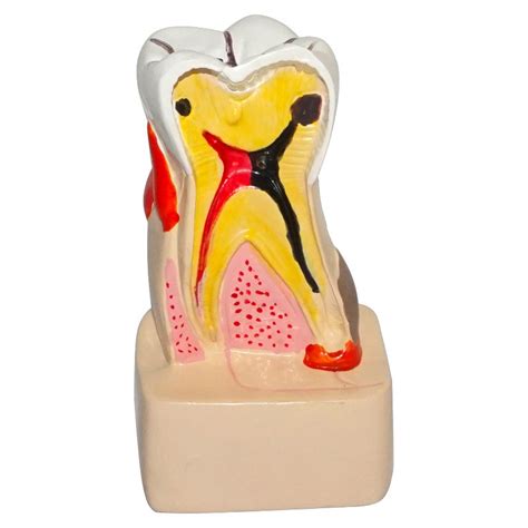 4 Times Teeth Periodontal Disease Models Human Teeth Model Medical Science Education Model