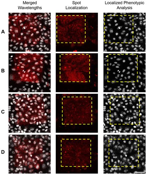 Genome Wide Microarray Screening Results Examples Of Data From The