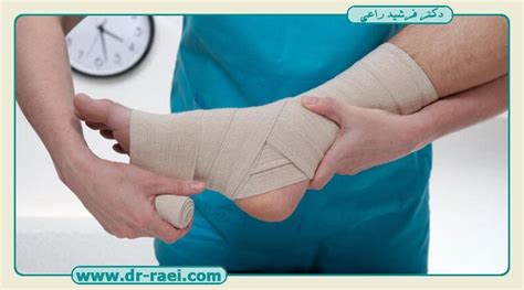 مچ پا آسیب‌های مچ پا دکتر فرشید راعی