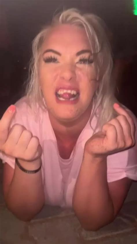 Mum Had To Get Unplanned Turkey Teeth On Holiday After Dance Accident