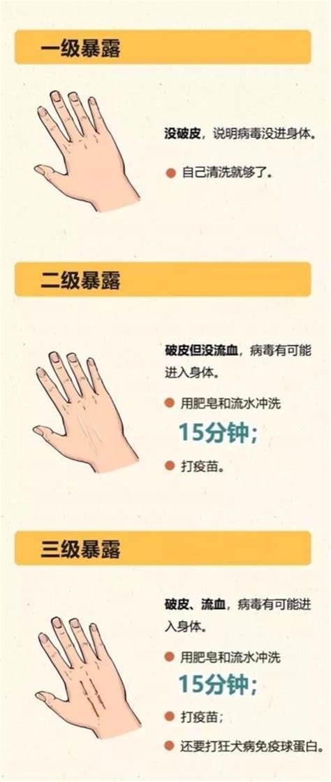 被猫狗咬伤怎么办 微医（挂号网）