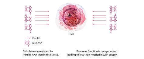 Breath Analysis And Diabetes Pnoe