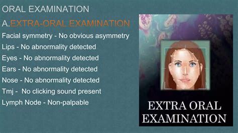 Leukoplakia Case Presentation And Investigation Of Premalignant
