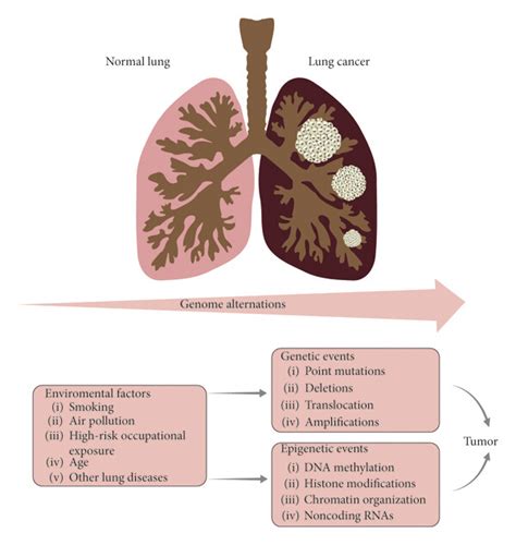 Epigenetics And Cancer Epigenetic Signatures In Cancer Proper