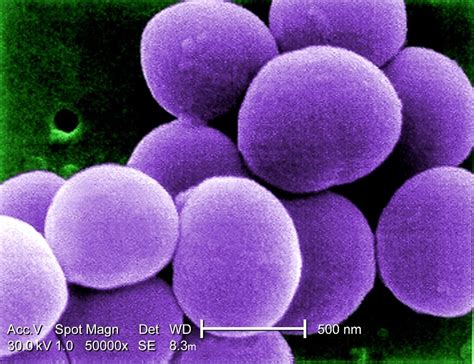 Free Picture Strain Staphylococcus Aureus Bacteria Vancomycin Intermediate Resistant Culture