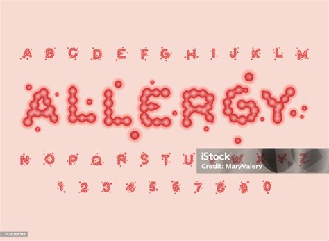 알레르기 글꼴 여드름 편지 여드름 편지 Abc는 윙윙 거리고 있습니다 농포 알파벳 다이어그램에 대한 스톡 벡터 아트 및 기타 이미지 다이어그램 만화 문제 Istock