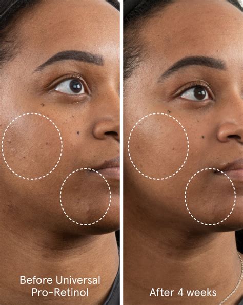 Universal Pro Retinol Glossier