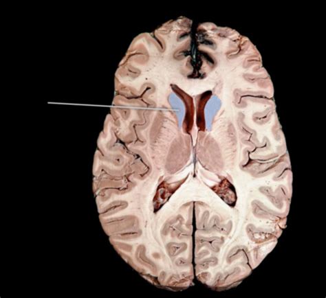 Brain Structures Flashcards Quizlet