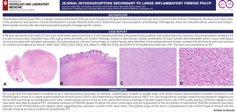 Pdf Jejunal Intussusception Secondary To Large Inflammatory Fibroid Polyp