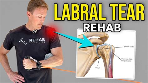 Labrum Tear Exercises A Safe And Effective Recovery Guide Researchhub Blog