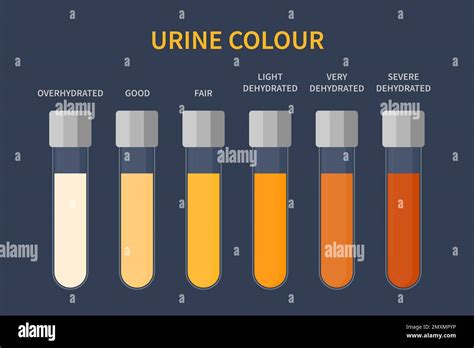 Urinalysis Levels At Isabel Baldwin Blog