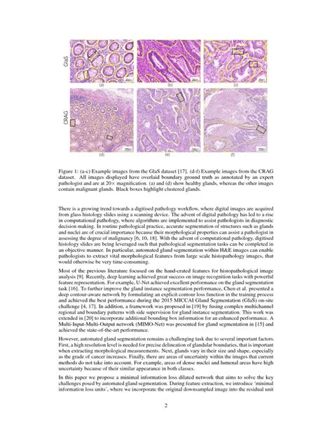 Mild Net Minimal Information Loss Dilated Network For Gland Instance